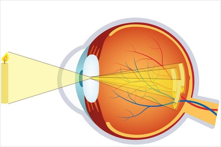 Αστιγματισμός Τι Είναι, Συμπτώματα & Laser Θεραπεία | Δρ. Σκουτέρης